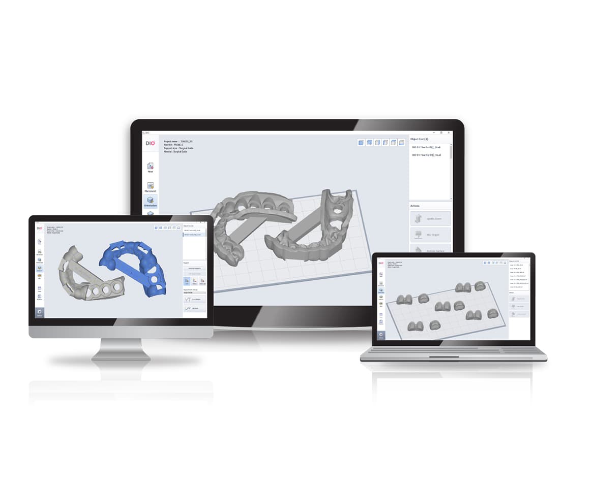 PROBO Z｜DIOデジタル株式会社｜インプラント・歯科医療用各種機器・材料